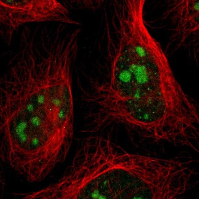 USP36 Polyclonal Antibody, Invitrogen 100 μL; Unconjugated:Antibodies ...