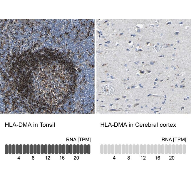 Invitrogen HLA-DMA Polyclonal Antibody 100 μL; Unconjugated:Antibodies ...