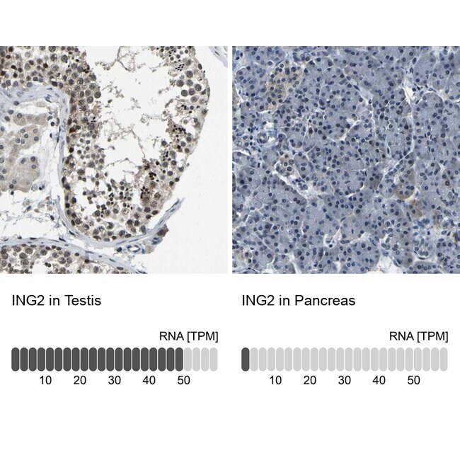 ING2 Polyclonal Antibody, Invitrogen 100 μL; Unconjugated:Antibodies ...