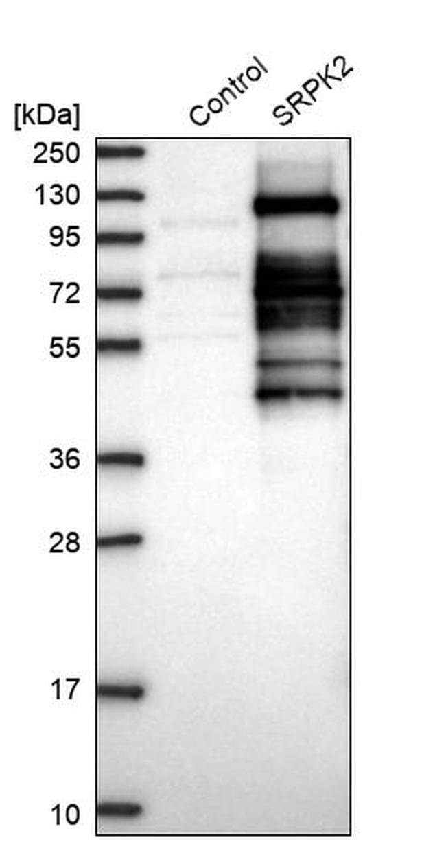 Invitrogen SRPK2 Polyclonal Antibody 100 μL | Buy Online | Invitrogen ...