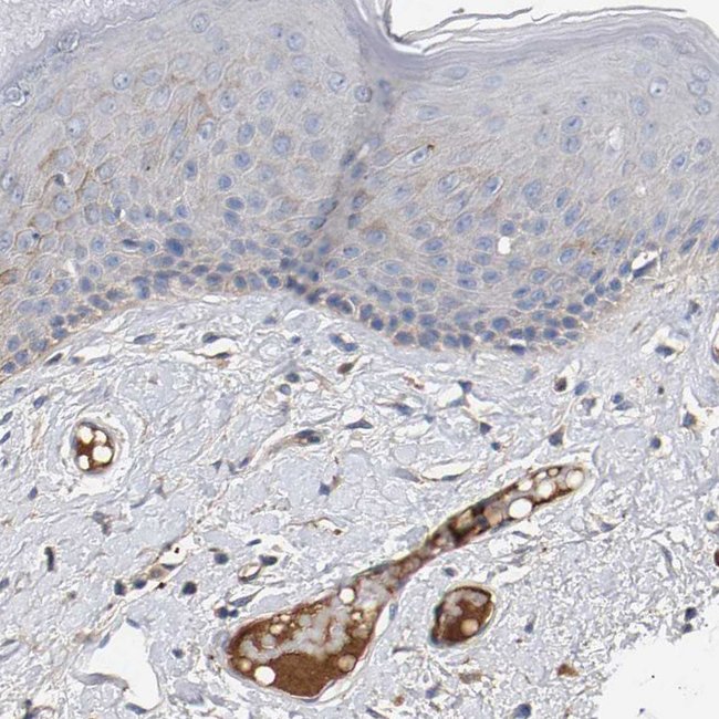 MAMDC2 Polyclonal Antibody, Invitrogen 100 μL; Unconjugated:Antibodies ...