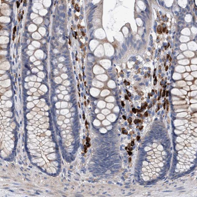 MAMDC2 Polyclonal Antibody, Invitrogen 100 μL; Unconjugated:Antibodies ...