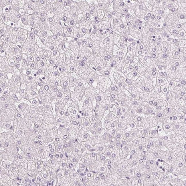MUC12 Polyclonal Antibody, Invitrogen 100 μL; Unconjugated:Antibodies ...