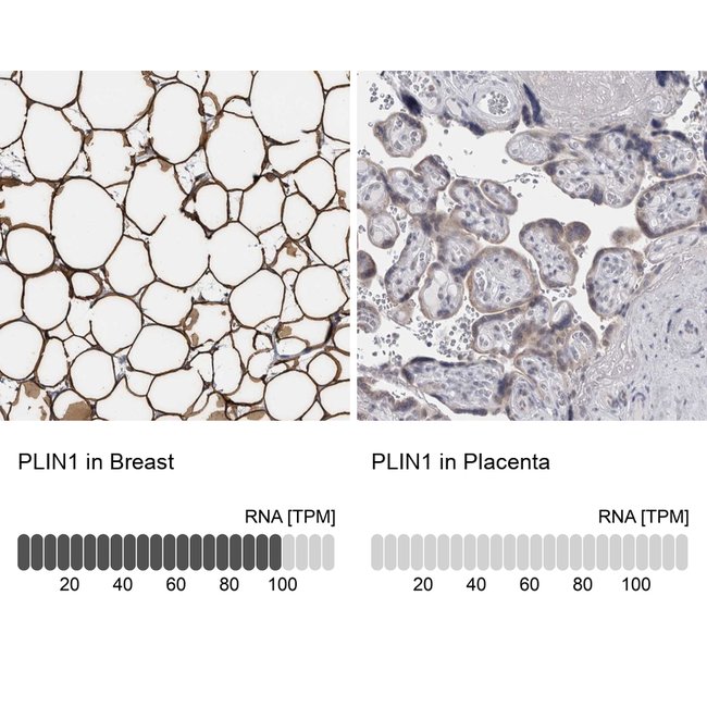 Perilipin 1 Polyclonal Antibody, Invitrogen 100 μL; Unconjugated ...