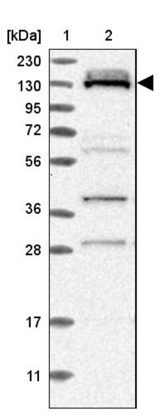 Invitrogen RBM12B Polyclonal Antibody 100 μL | Buy Online | Invitrogen ...