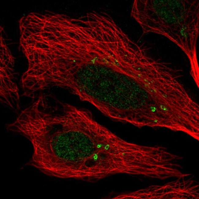 Invitrogen CEP112 Polyclonal Antibody 100 μL; Unconjugated:Antibodies ...