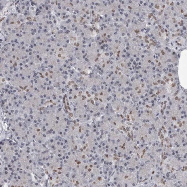 Invitrogen YAF2 Polyclonal Antibody 100 μL | Buy Online | Invitrogen ...