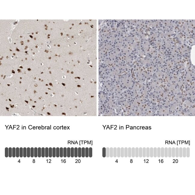 YAF2 Polyclonal Antibody, Invitrogen 100 μL; Unconjugated:Antibodies ...