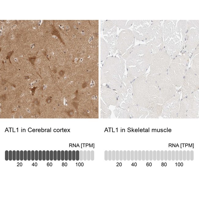 Invitrogen ATL1 Polyclonal Antibody 100 μL; Unconjugated:Antibodies ...
