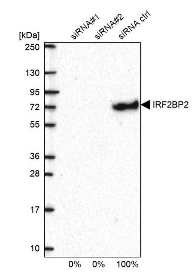 Invitrogen IRF2BP2 Polyclonal Antibody 100 μL; Unconjugated:Antibodies ...
