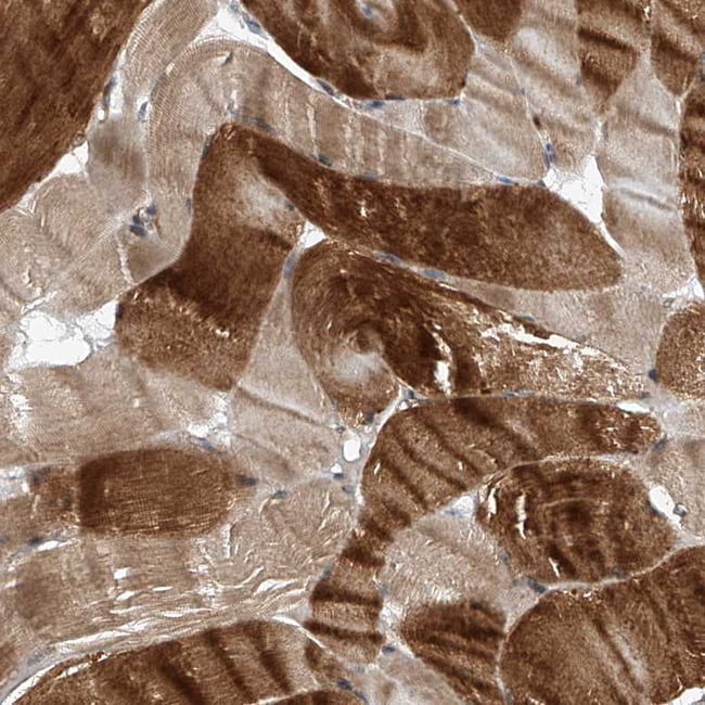 Invitrogen CEP85L Polyclonal Antibody 100 μL; Unconjugated:Antibodies ...