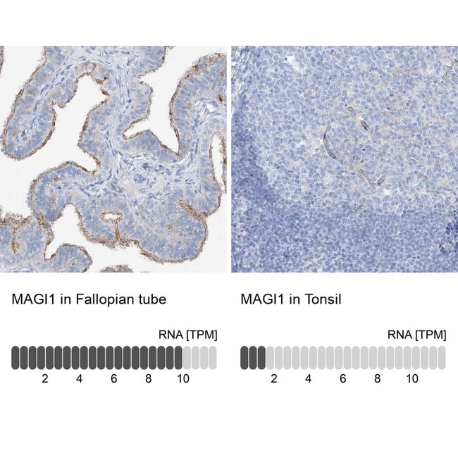 Invitrogen MAGI1 Polyclonal Antibody 100 μL | Buy Online | Invitrogen ...