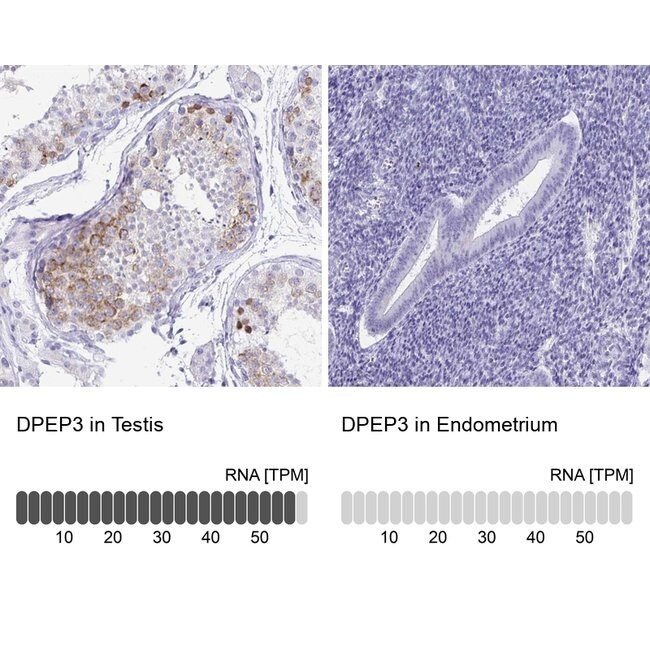 Invitrogen DPEP3 Polyclonal Antibody 100 μL; Unconjugated:Antibodies ...
