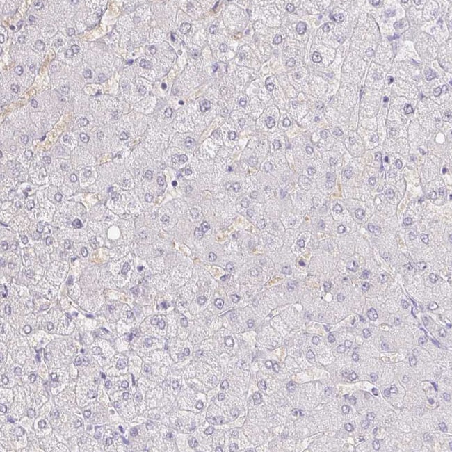 Invitrogen ZG16B Polyclonal Antibody 100 μL; Unconjugated:Antikroppar ...