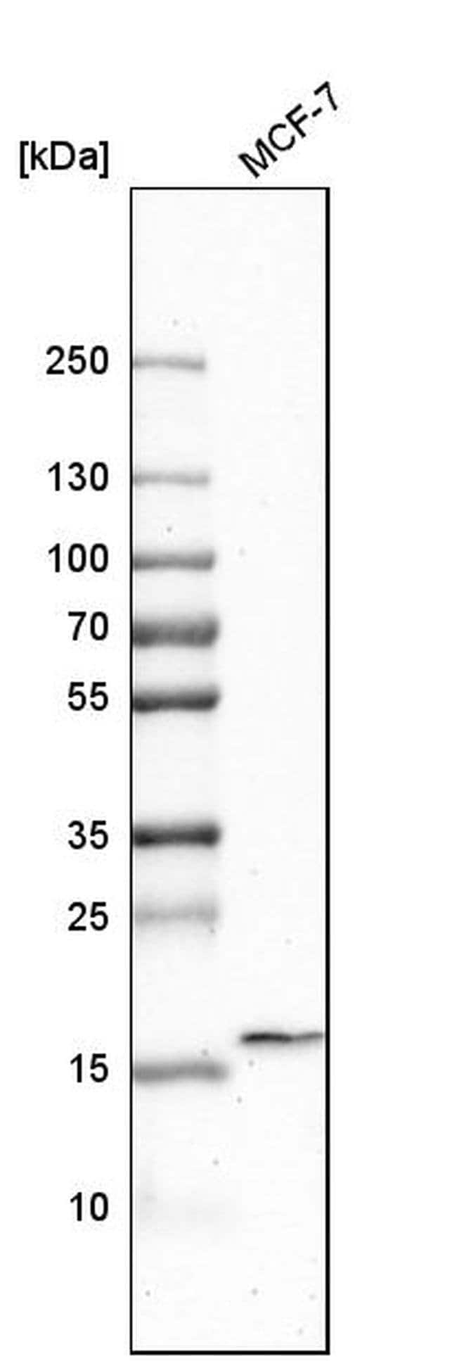 Invitrogen ZG16B Polyclonal Antibody 100 μL; Unconjugated:Antikroppar ...