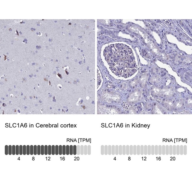 SLC1A6 Polyclonal Antibody, Invitrogen 100 μL; Unconjugated:Antibodies ...