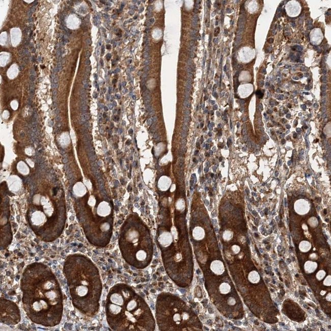 Invitrogen DEXI Polyclonal Antibody 100 μL; Unconjugated:Antikroppar ...