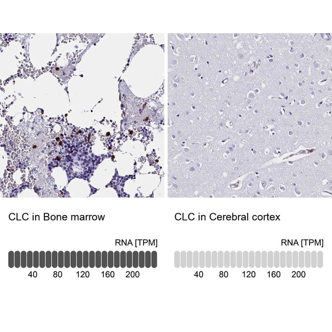 Galectin 10 Polyclonal Antibody, Invitrogen 100 μL; Unconjugated ...