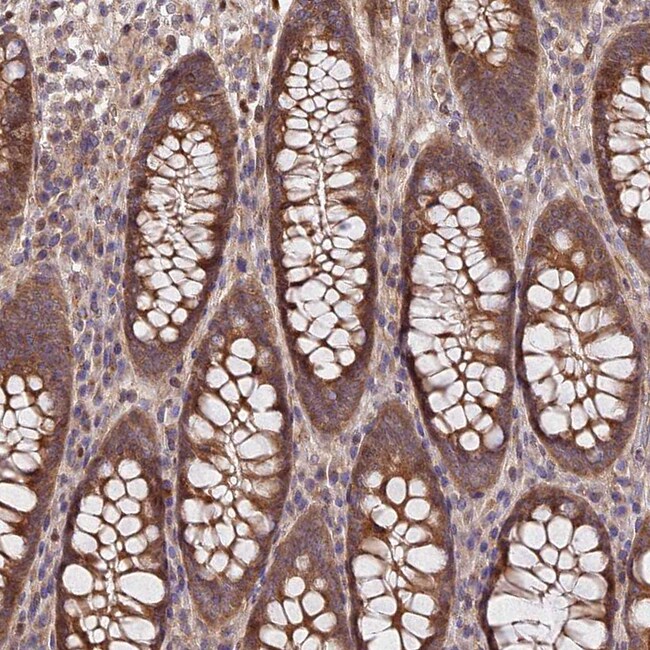 Invitrogen SMG6 Polyclonal Antibody 100 μL; Unconjugated:Anticorps ...