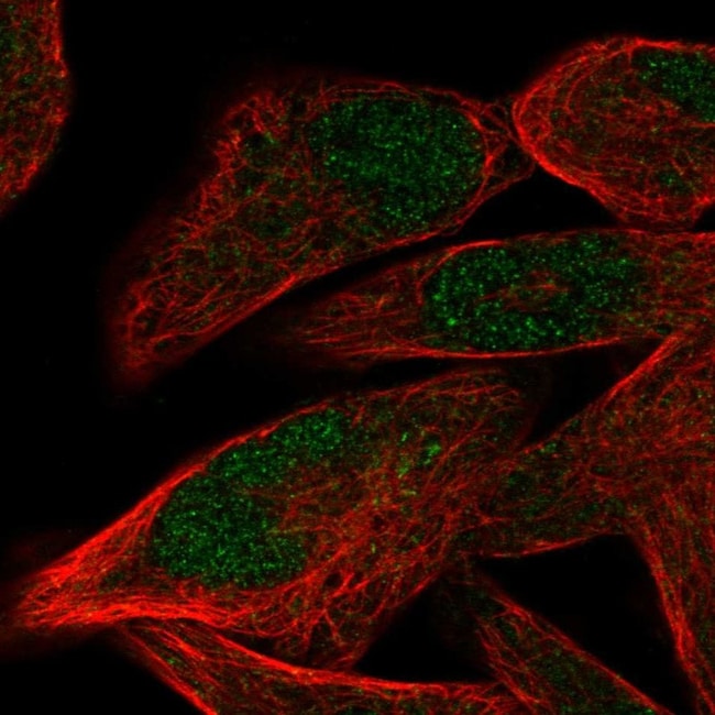 Invitrogen PRDM12 Polyclonal Antibody 100 μL | Buy Online | Invitrogen ...