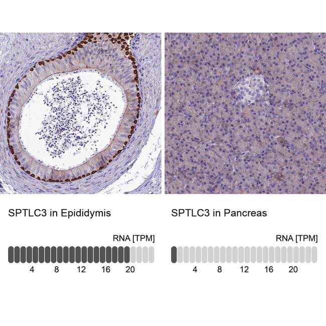 Invitrogen SPTLC3 Polyclonal Antibody 100 μL; Unconjugated:Antibodies ...