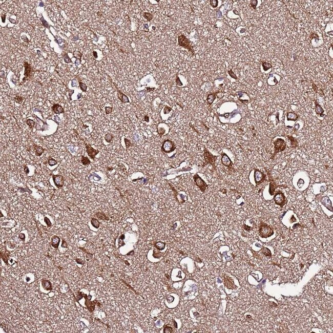 Invitrogen SLC41A3 Polyclonal Antibody 100 μL; Unconjugated:Antikroppar ...