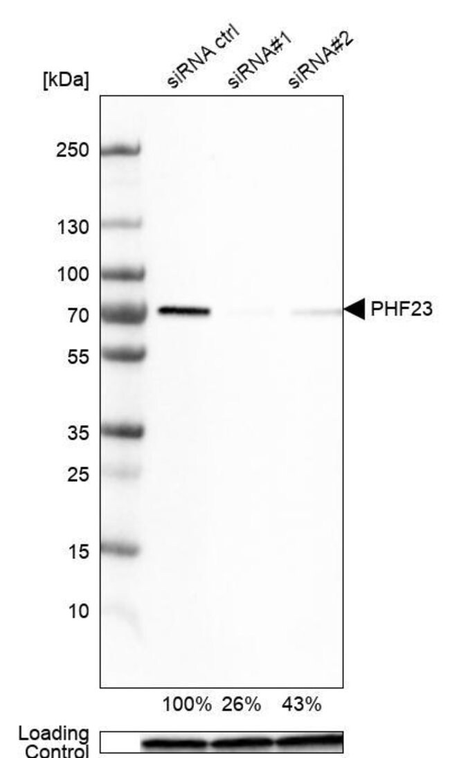 PHF23 Polyclonal Antibody, Invitrogen 100 μL; Unconjugated:Antibodies ...