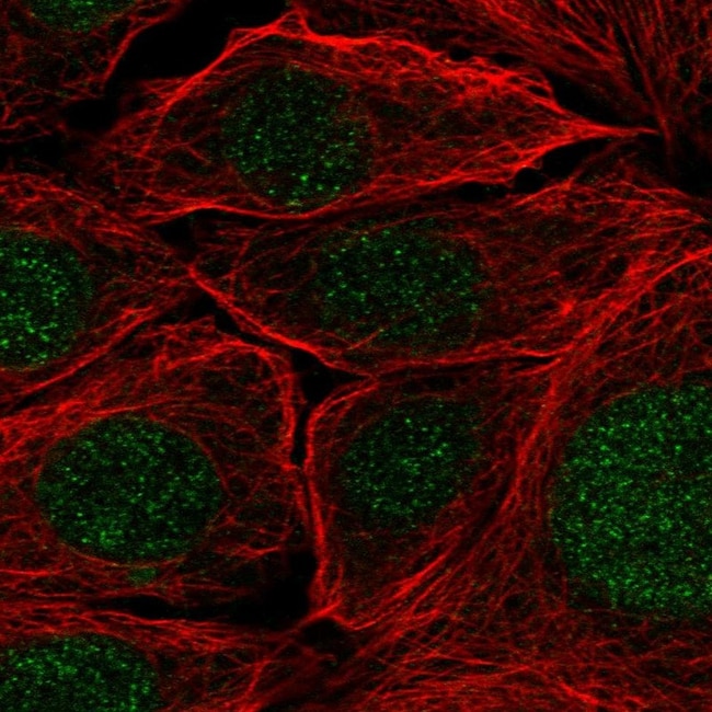 Invitrogen PR38A Polyclonal Antibody 100 μL; Unconjugated:Antibodies ...