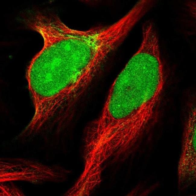 Pellino 2 Polyclonal Antibody, Invitrogen 100 μL; Unconjugated ... Pellino 2 Polyclonal Antibody, Invitrogen 100 μL; Unconjugated ...