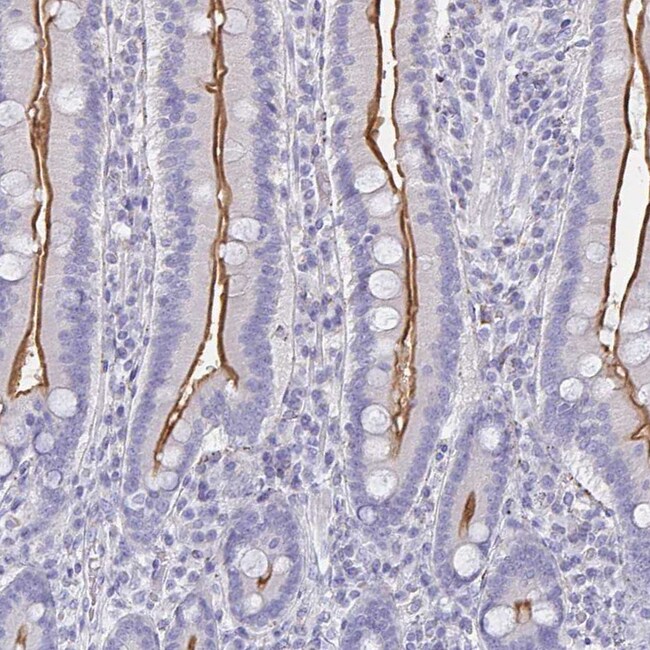 Invitrogen MGAM2 Polyclonal Antibody 100 μL; Unconjugated:Antibodies ...