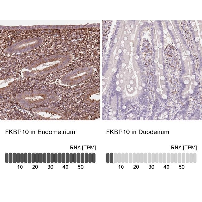 FKBP10 Polyclonal Antibody, Invitrogen™ 100 μL; Unconjugated Primary ...