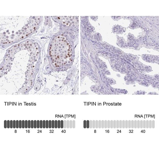 Invitrogen TIPIN Polyclonal Antibody 100 μL; Unconjugated:Antibodies ...
