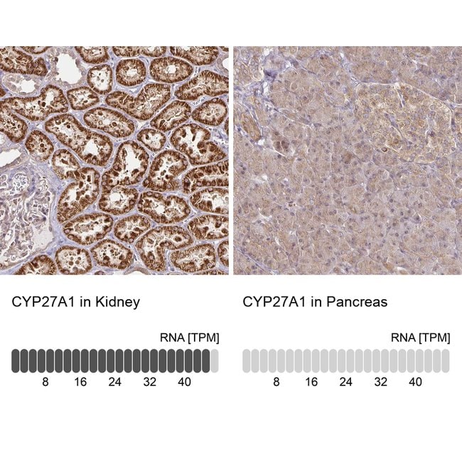 CYP27A1 Polyclonal Antibody, Invitrogen™ 100 μL; Unconjugated Primary ...