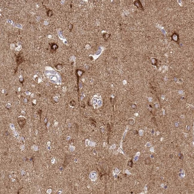 Invitrogen SLC9A6 Polyclonal Antibody 100 μL; Unconjugated:Antibodies ...