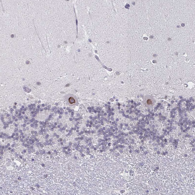 Invitrogen NUP133 Polyclonal Antibody 100 μL; Unconjugated:Antikroppar ...