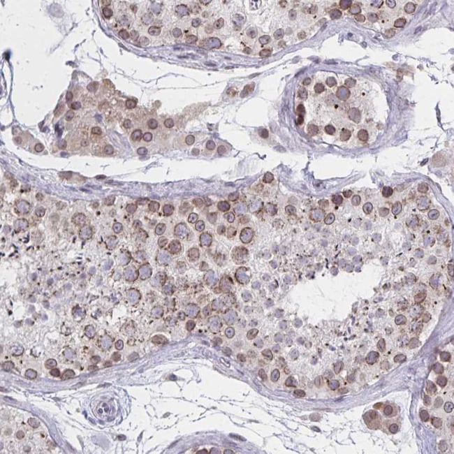Invitrogen NUP133 Polyclonal Antibody 100 μL | Buy Online | Invitrogen ...