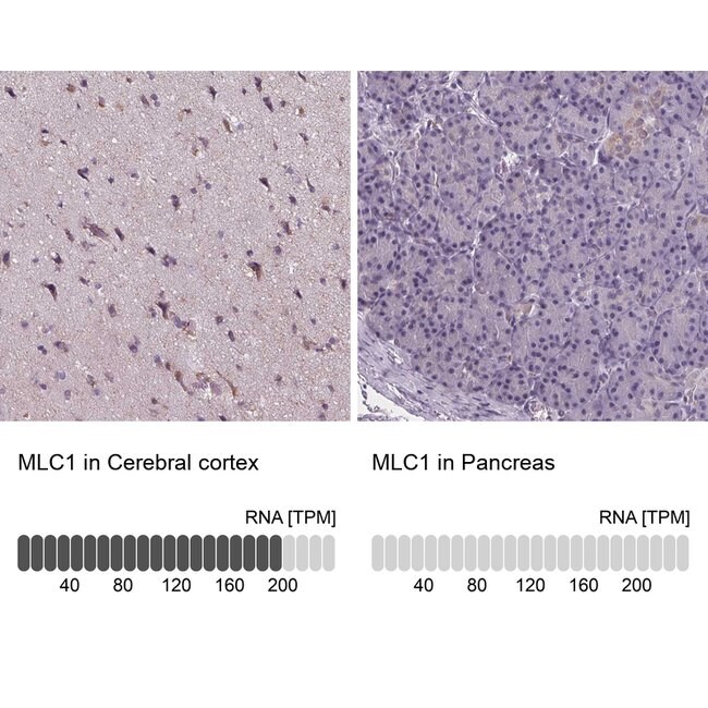 MLC1 Polyclonal Antibody, Invitrogen 100 μL; Unconjugated:Antibodies ...