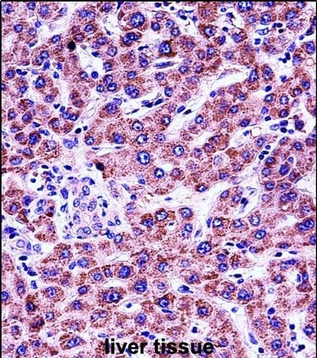 GYPB Polyclonal Antibody, Invitrogen 400 μL; Unconjugated:Antibodies ...