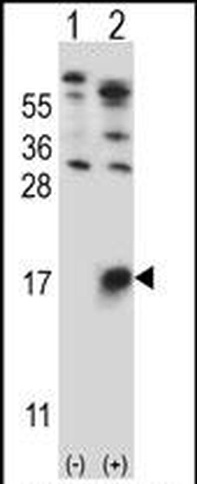 GYPB Polyclonal Antibody, Invitrogen 400 μL; Unconjugated:Antibodies ...