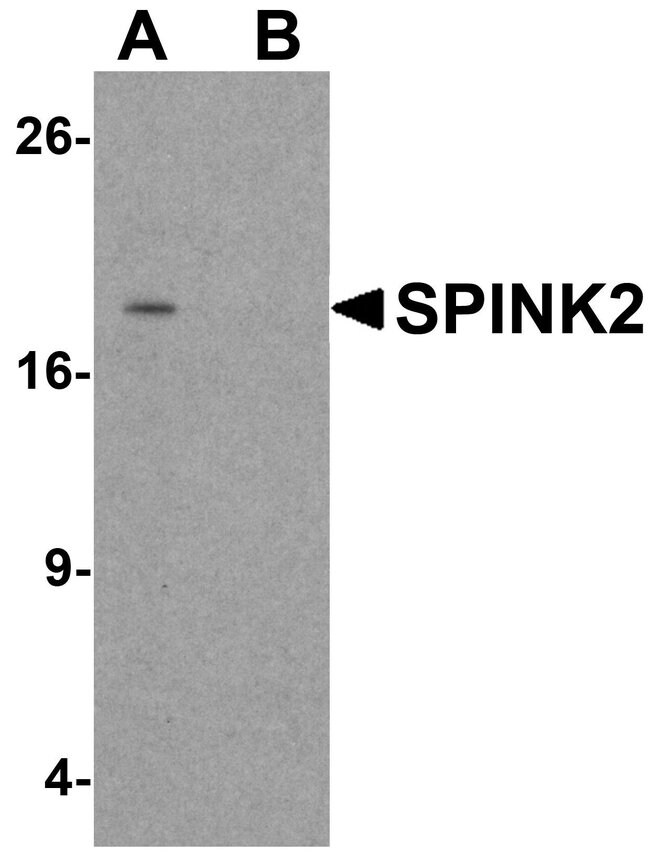SPINK2 Polyclonal Antibody, Invitrogen 100 μg; Unconjugated:Antibodies ...