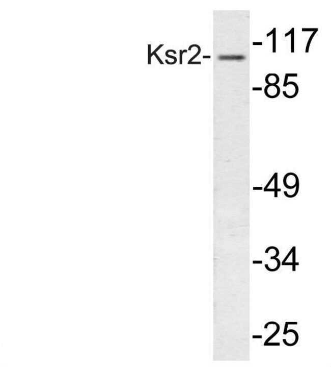 KSR2 Polyclonal Antibody, Invitrogen 100 μL; Unconjugated:Antibodies ...