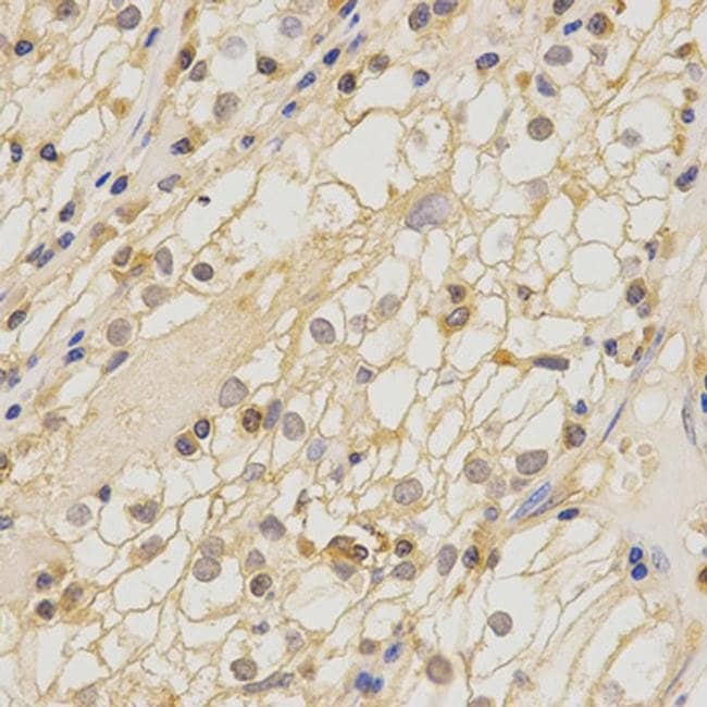 Claudin 11 Rabbit anti-Human, Mouse, Rat, Polyclonal, Invitrogen 100 µL ...
