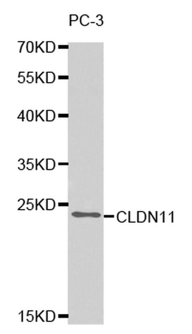 Claudin 11 Rabbit anti-Human, Mouse, Rat, Polyclonal, Invitrogen 100 µL ...