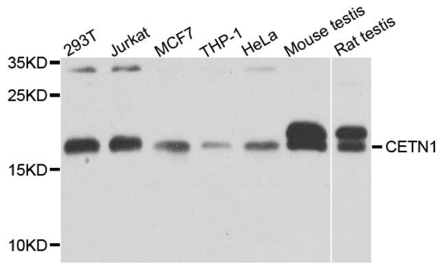 Centrin 1 Polyclonal Antibody, Invitrogen 100 μL; Unconjugated ...