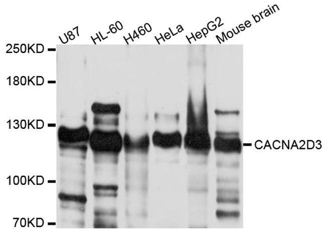 CACNA2D3 Polyclonal Antibody, Invitrogen 100 μL; Unconjugated ...