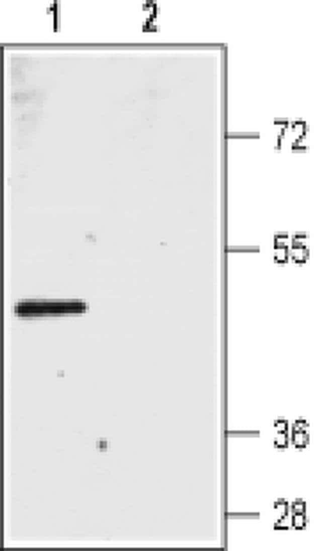 Bestrophin 2 (extracellular) Polyclonal Antibody, Invitrogen™ 50 μL ...