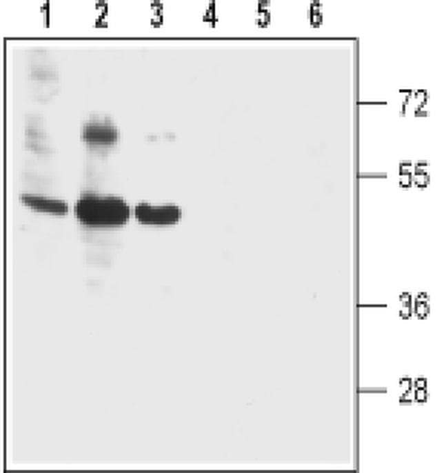 Bestrophin 2 (extracellular) Polyclonal Antibody, Invitrogen™ 50 μL ...
