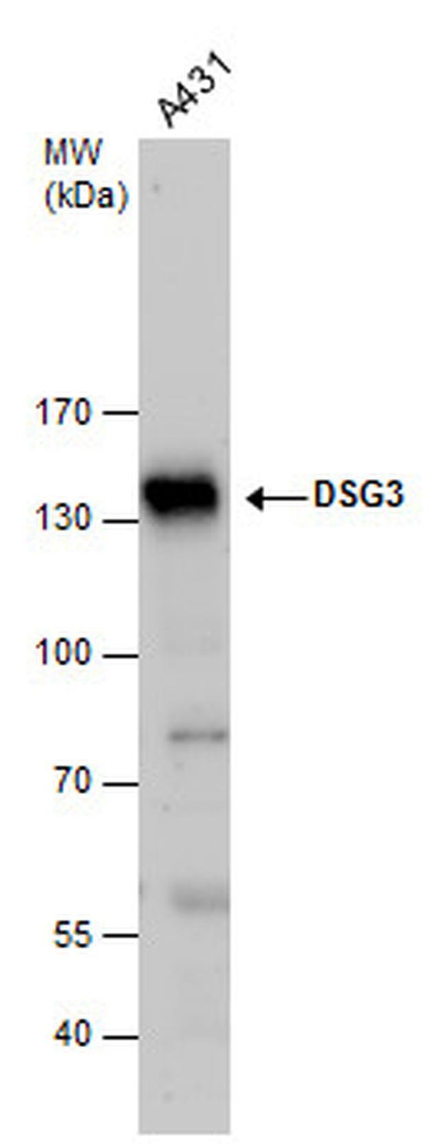 Desmoglein 3 Polyclonal Antibody, Invitrogen 100 μL; Unconjugated ...