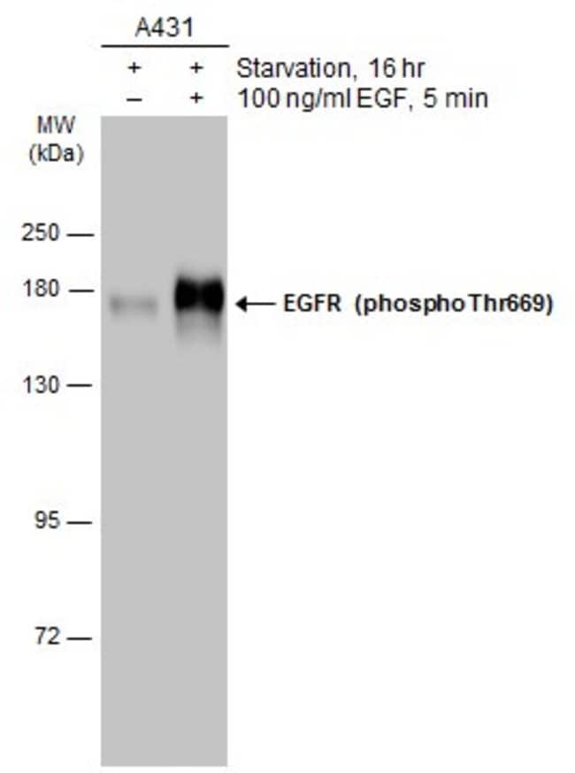 Invitrogen Phospho-EGFR (Thr669) Polyclonal Antibody 100 μL; Unconjugated:Antikroppar | Fisher ...