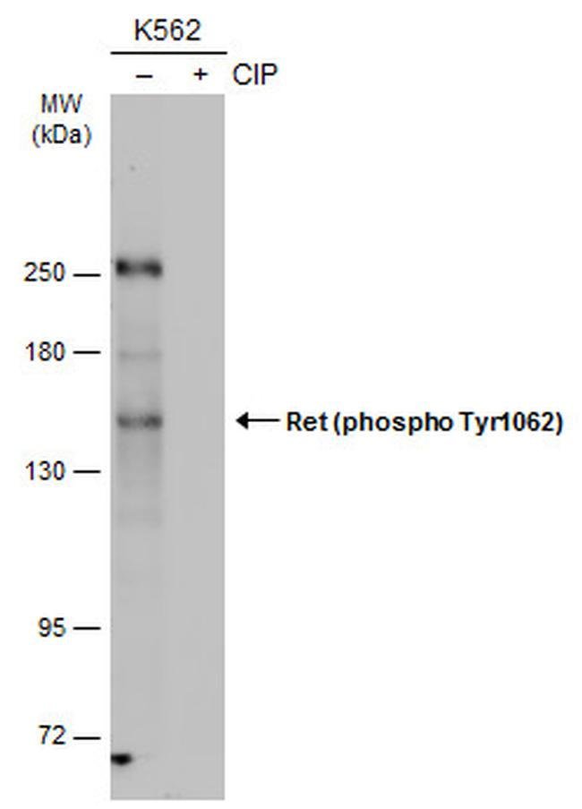 Phospho-RET (Tyr1062) Polyclonal Antibody, Invitrogen 100 μL; Unconjugated:Antibodies, | Fisher ...